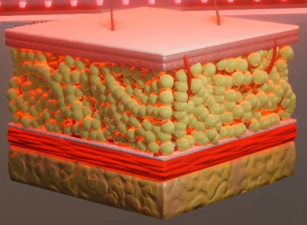 How does it work? – UltraSlim® North Georgia